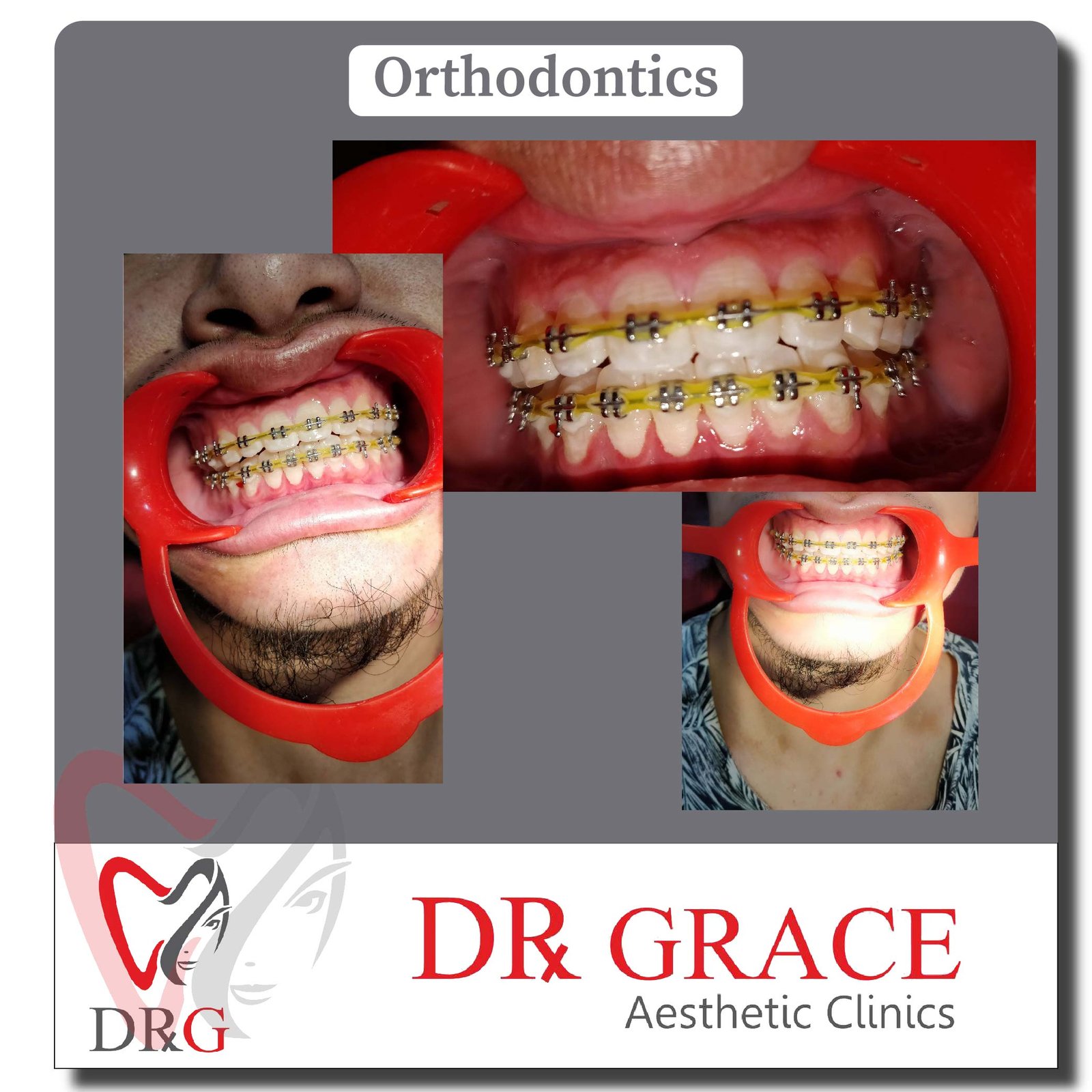 Dr.Grace-Dental-Gallery